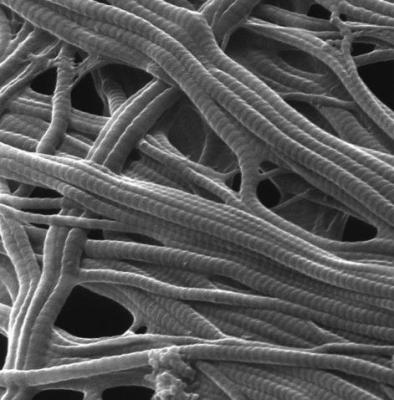 Imaging Biological Samples Using The ORION PLUS Helium Ion Microscope ...