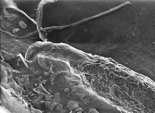 Applications of Scanning Electron Microscopes in Forensic ...